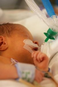 Reduction in Unplanned Extubation - MANA